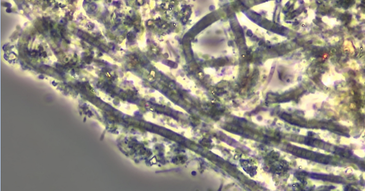 Bug of the Month: Eickelboom Filament… | Treatment Plant Operator