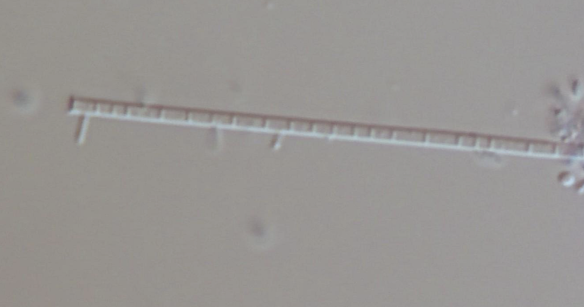 Bug of the Month: The Interesting Case of… | Treatment Plant Operator